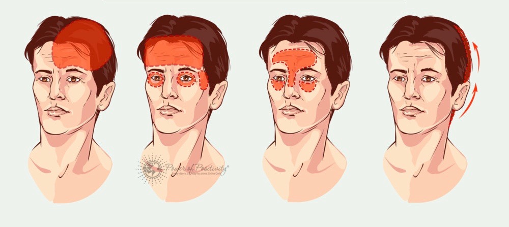 4 Types de Maux de Tête que l’on ne Devrait Jamais Ignorer