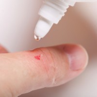 10 Remèdes Maison contre l’Herbe à Puce